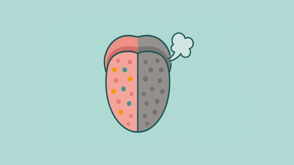 What is Vaper's Tongue? Causes, Symptoms & Proven Fixes - MIST Blog